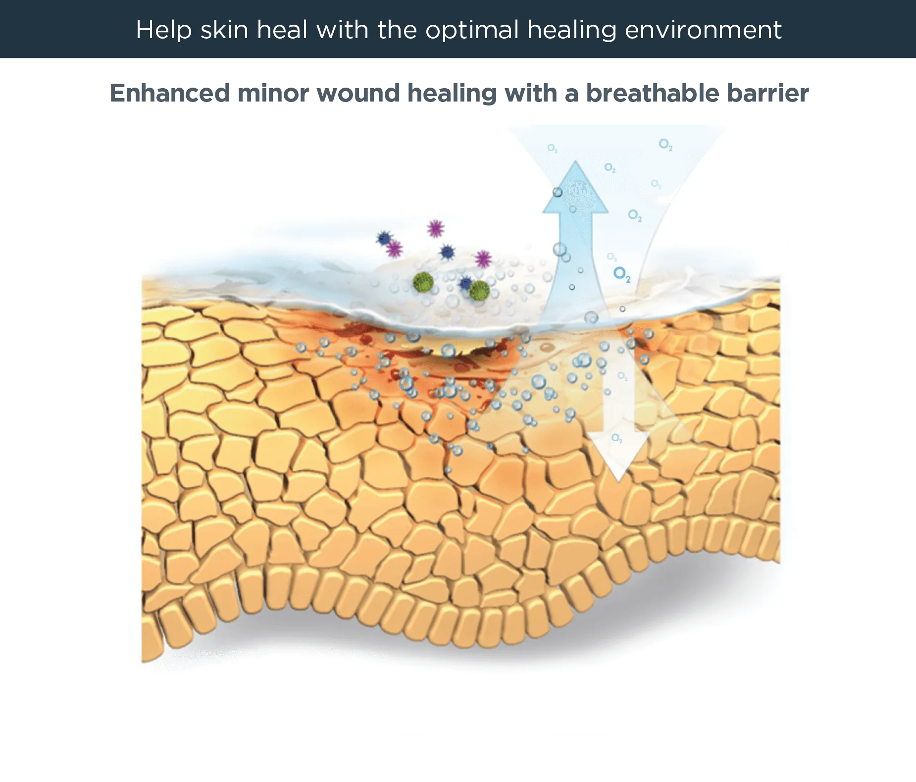 Wound healing with breathable barrier