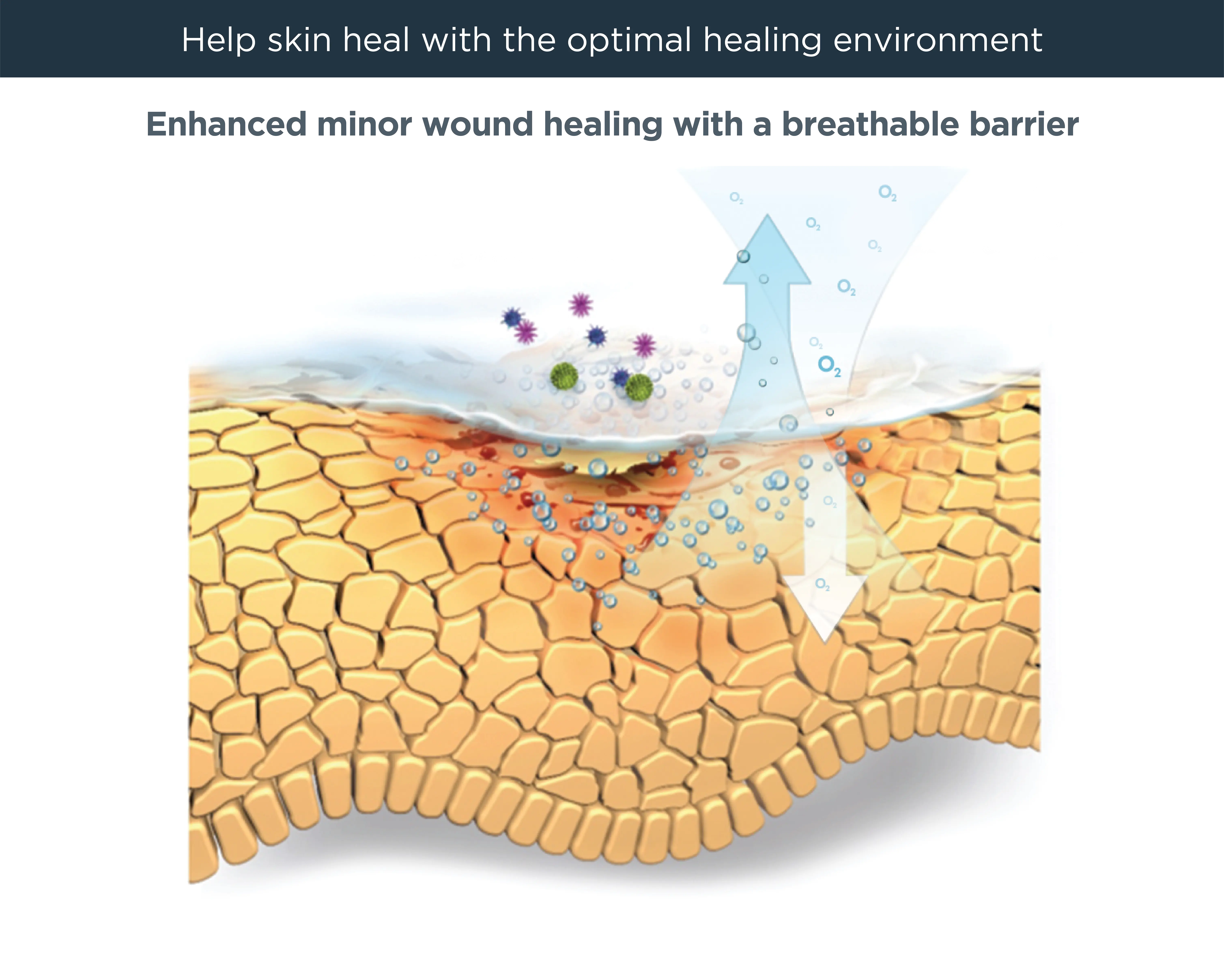 Wound healing with breathable barrier