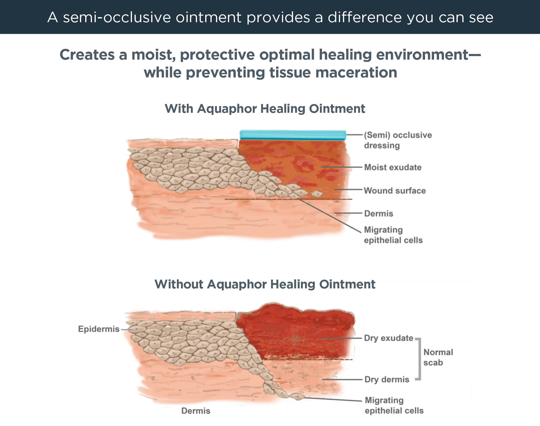 Showing difference of wound healing with semi-oculsive ointment