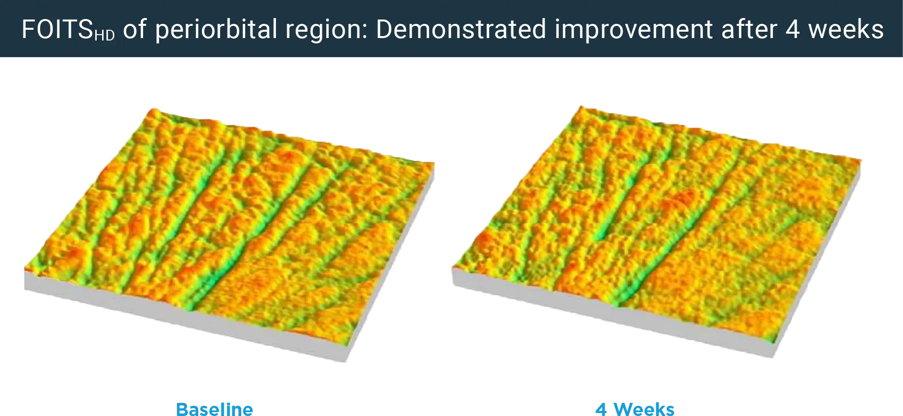 Two images showing visibly smoother skin in 4 weeks after using Night cream